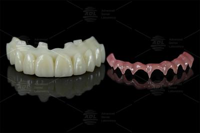 China Screw Retained 3D Printed Implant Support Bar for Try In Direct to Fixture of ALL ON X From Chinese Dental Lab for sale