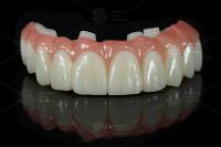 China Screw Retained 3D Printed Implant Support Bar for Try In Direct to Fixture of ALL ON X From Chinese Dental Lab for sale