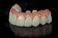 China Screw Retained 3D Printed Implant Support Bar for Try In Direct to Fixture of ALL ON X From Chinese Dental Lab for sale