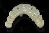 China Screw Retained 3D Printed Implant Support Bar for Try In Direct to Fixture of ALL ON X From Chinese Dental Lab for sale