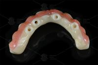China Screw Retained 3D Printed Implant Support Bar for Try In Direct to Fixture of ALL ON X From Chinese Dental Lab for sale