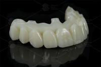 China Screw Retained 3D Printed Implant Support Bar for Try In Direct to Fixture of ALL ON X From Chinese Dental Lab for sale