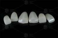 China Hybrid Ceramic Vita Enamic Single Tooth Restorations With High Translucency for sale