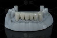China Hybrid Ceramic Vita Enamic Single Tooth Restorations With High Translucency for sale