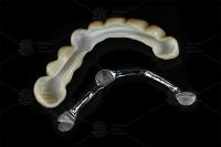 China Customizable Reinforcement Titanium Bar Combined with Milled Zirconia providing dental implant framework solutions for sale