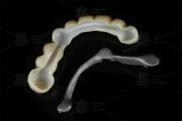 China Customizable Reinforcement Titanium Bar Combined with Milled Zirconia providing dental implant framework solutions for sale