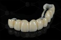 China Customizable Reinforcement Titanium Bar Combined with Milled Zirconia providing dental implant framework solutions for sale