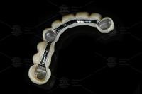 China Customizable Reinforcement Titanium Bar Combined with Milled Zirconia providing dental implant framework solutions for sale