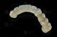 China Customizable Reinforcement Titanium Bar Combined with Milled Zirconia providing dental implant framework solutions for sale