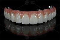 China China Dental Lab Fast Turnaround Time In 72 Hours Provides High Quality All on X for sale