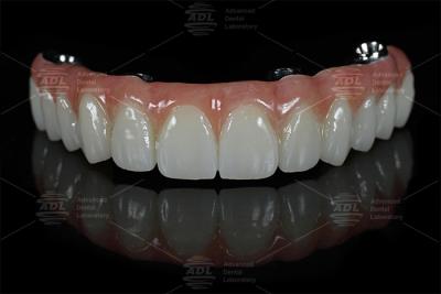 China China Dental Lab Fast Turnaround Time In 72 Hours Provides High Quality All on X for sale