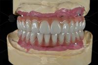 China China Dental Lab Fast Turnaround Time In 72 Hours Provides High Quality All on X for sale