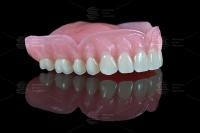 China China Dental Lab Premium Removable Denture products at dental lab with multiple shipping options UPS DHL FEDEX catering to dental clinics and labs globally for sale