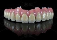 China China Dental Lab Hybrid Bridge Implant Bar Malong Design Screw retained Or Cemented Installation Method For Precision Dental Applications for sale