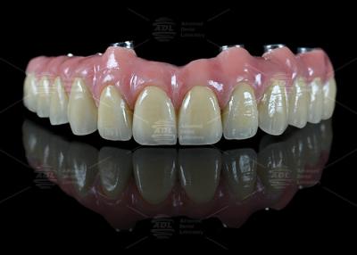 China China Dental Lab Hybrid Bridge Implant Bar Malong Design Screw retained Or Cemented Installation Method For Precision Dental Applications for sale