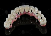 China China Dental Lab Hybrid Bridge Implant Bar Malong Design Screw retained Or Cemented Installation Method For Precision Dental Applications for sale