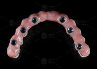 China China Dental Lab Hybrid Bridge Implant Bar Malong Design Screw retained Or Cemented Installation Method For Precision Dental Applications for sale