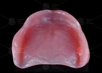 China China Dental Lab High Esthetics Customized Full Acrylic Denture Full Service for Worldwide for sale