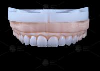 China China Dental Lab Over 13 Years In Dental Lab Industry Providing Emax Veneer 16 Shades To Meet Diverse Dental Restoration Needs for sale