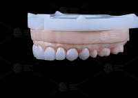 China China Dental Lab Over 13 Years In Dental Lab Industry Providing Emax Veneer 16 Shades To Meet Diverse Dental Restoration Needs for sale