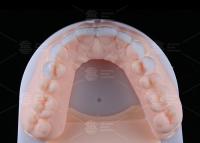 China China Dental Lab Over 13 Years In Dental Lab Industry Providing Emax Veneer 16 Shades To Meet Diverse Dental Restoration Needs for sale