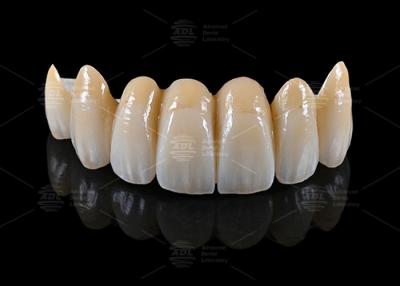 China China Dental Lab Providing AIDITE ZIRCONIA BLOCK Materials Alongside Turnaround Time In 72 Hours For Dental Manufacturing for sale