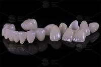 China China Dental Lab Porcelain Fused To Zirconia High Strength Providing Tailored Services To International Dental Lab And Dentist for sale