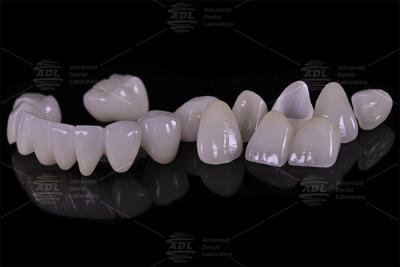 China China Dental Lab Porcelain Fused To Zirconia High Strength Providing Tailored Services To International Dental Lab And Dentist for sale