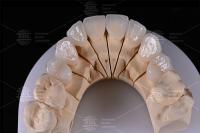 China China Dental Lab Porcelain Fused To Zirconia High Strength Providing Tailored Services To International Dental Lab And Dentist for sale