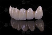 China Top 5 China dental lab providers Porcelain Fused To Zirconia ensuring turnaround time in 72 hours service for dental offices and labs for sale