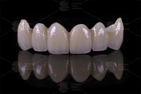China Top 5 China dental lab providers Porcelain Fused To Zirconia ensuring turnaround time in 72 hours service for dental offices and labs for sale
