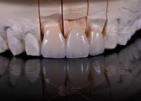 China China Dental Lab Accurate Precision Of Margins Layered Zirconia Hypoallergenic Biocompatible Dental Material For Durable And Restorations for sale