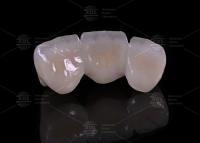 China China Dental Lab Accurate Precision Of Margins Layered Zirconia Hypoallergenic Biocompatible Dental Material For Durable And Restorations for sale