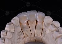 China China Dental Lab Accurate Precision Of Margins Layered Zirconia Hypoallergenic Biocompatible Dental Material For Durable And Restorations for sale