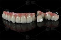 China Hypoallergenic PFZ dental solutions tailored to meet diverse clinical and dental lab needs services ensuring precision for sale