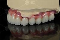 China Hypoallergenic PFZ dental solutions tailored to meet diverse clinical and dental lab needs services ensuring precision for sale