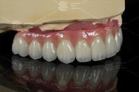 China Hypoallergenic PFZ dental solutions tailored to meet diverse clinical and dental lab needs services ensuring precision for sale