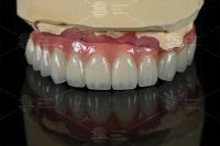 China Hypoallergenic PFZ dental solutions tailored to meet diverse clinical and dental lab needs services ensuring precision for sale