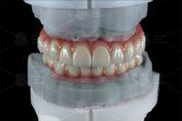 China China Dental Lab Titanium And Zirconia All On X In 16 Shades Including A1 A2 A3 From Dental Lab For Natural Dental Aesthetics for sale