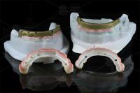 China China Dental Lab Titanium And Zirconia All On X In 16 Shades Including A1 A2 A3 From Dental Lab For Natural Dental Aesthetics for sale