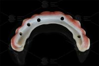 China China Dental Lab Titanium And Zirconia All On X In 16 Shades Including A1 A2 A3 From Dental Lab For Natural Dental Aesthetics for sale