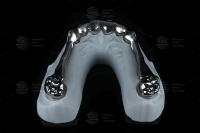 China China Dental Lab Outsource Dental Lab Ti Reinforcement Bar With Full Zirconia Providing Competitive Pricing With Volume Discounts Tailored To Dental Professionals Requiring And Manufacturing for sale