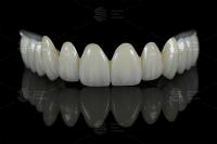 China China Dental Lab Outsource Dental Lab Ti Reinforcement Bar With Full Zirconia Providing Competitive Pricing With Volume Discounts Tailored To Dental Professionals Requiring And Manufacturing for sale