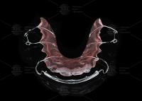 China China Dental Lab Stainless Steel And Acrylic Orthodontic Hawley Retainer For Orthodontic Treatment for sale