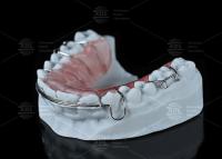 China China Dental Lab Stainless Steel And Acrylic Orthodontic Hawley Retainer For Orthodontic Treatment for sale