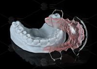 China China Dental Lab Stainless Steel And Acrylic Orthodontic Hawley Retainer For Orthodontic Treatment for sale