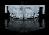 China China Dental Lab Customizable Hawley Retainer Comfortably Removable Retains Teeth Position Effectively for sale