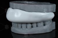 China Convenient Occlusal Sport Guard Bite Splint Design Easy To Clean Comfortable Protective Device For Teeth Grinding for sale