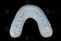 China Convenient Occlusal Sport Guard Bite Splint Design Easy To Clean Comfortable Protective Device For Teeth Grinding for sale