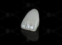 China China Dental Lab Hybrid Ceramic Vita Enamic Dental with Translucency for Single Tooth Restorations for sale